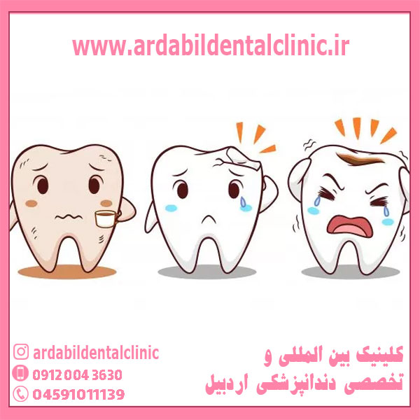 داروهای کنترل درد و التهاب دندان - کلینیک دندان پزشکی اردبیل